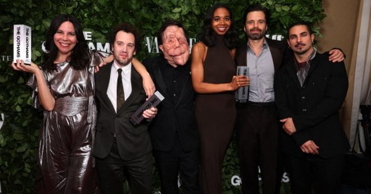 Adam Pearson: Adam Pearson, el actor con neurofibromatosis que desafía ...