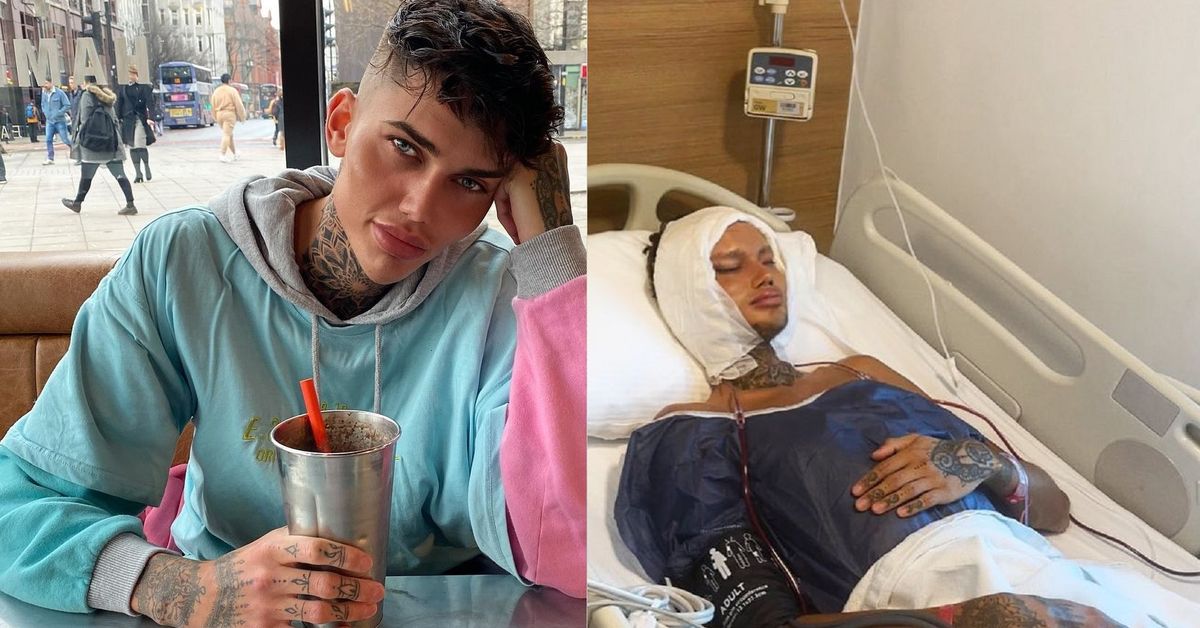 Levi Jed Murphy: Famoso tiktoker se somete a 5 cirugías plásticas a la ...