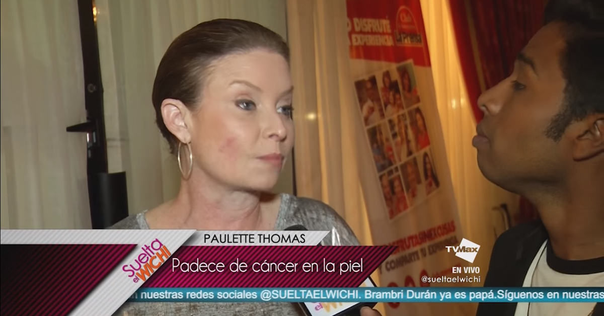 Vídeo | Paulette Thomas nos habla sobre el cáncer de piel - Videos ...