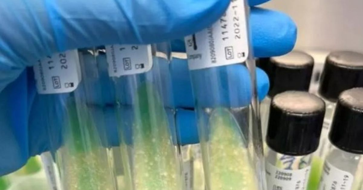 Panamá ha reducido la tasa mortalidad por tuberculosis en los últimos 7 años - Nacionales | Tvn ...