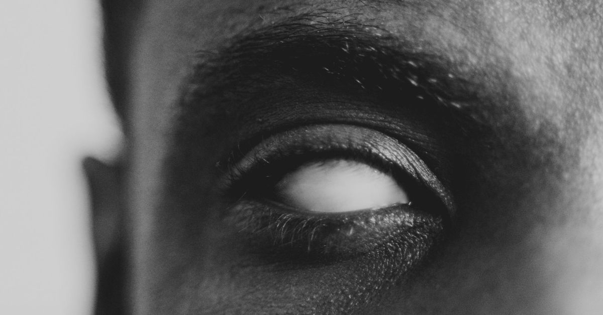 Shiky Clement: Presentador de TV se sometió a cirugía estética porque ...